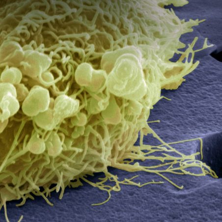 3D Spheroids | 3D Spheroid Cell Culture Models | Corning