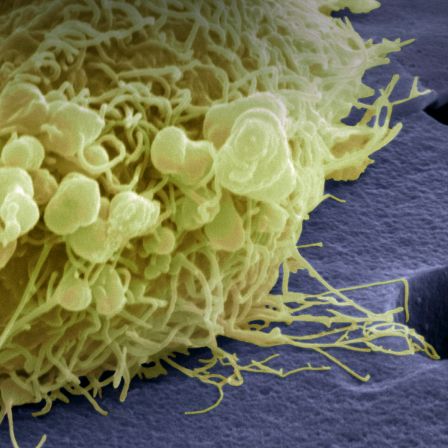 3D Spheroid Models | 3D Cell Culture Models | Corning