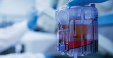 Overcoming Barriers to Cellular Immunotherapy Manufacturing