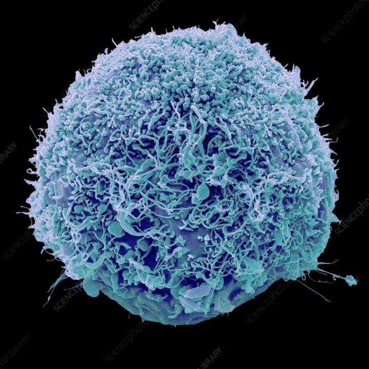 What are Mesenchymal Stem Cells (MSCs)? | Understanding MSCs, their ...