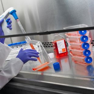 使用ガイドライン | Transwell® (トランズウェル) パーミアブルサポート、Snapwell™ (スナップウェル) および ...