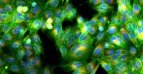 Spheroid Microplates | Microplates | Corning