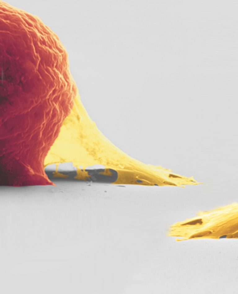 Corning® コラーゲン | 細胞培養表面｜Corning