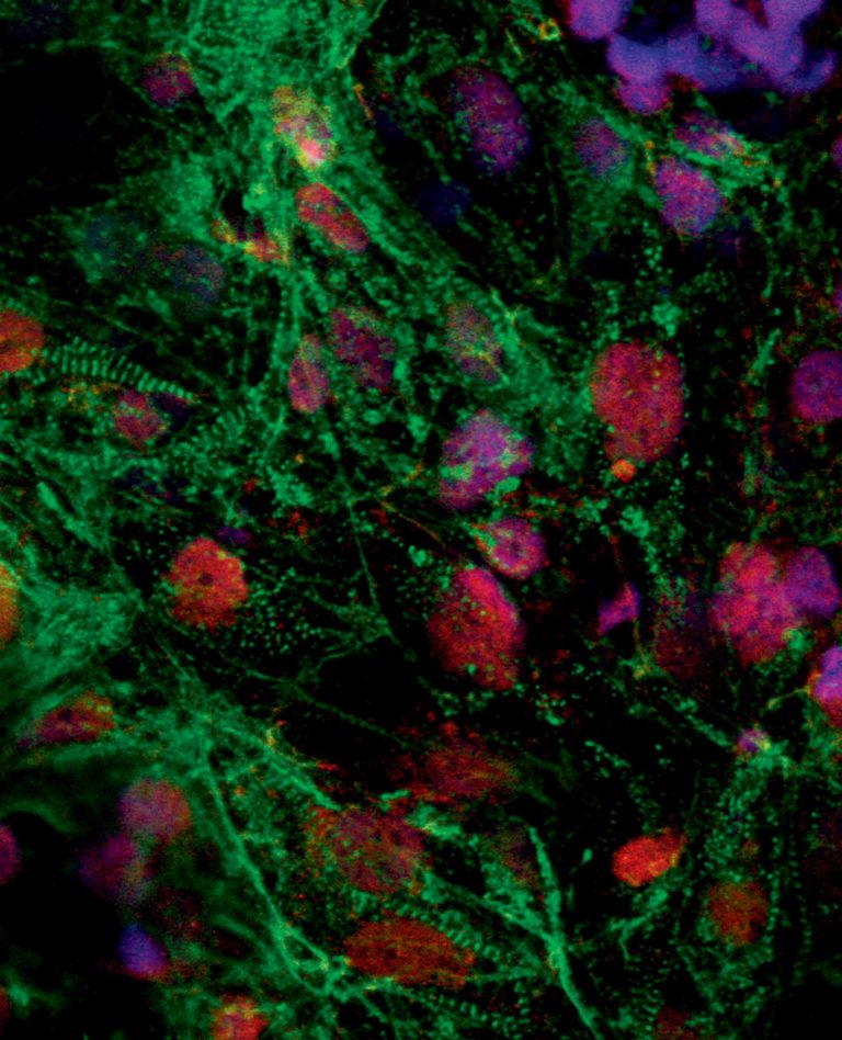 Corning® マトリゲル基底膜マトリックス｜細胞外基質 | Corning