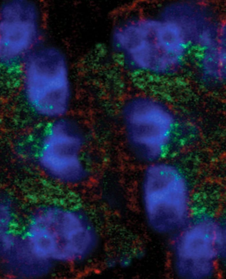 Corning® Matrigel® Matrix for Organoids | Disease Modeling and Drug ...