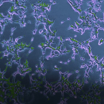 Corning® CellBIND® Surface | Negatively Charged Advanced Tissue Culture ...