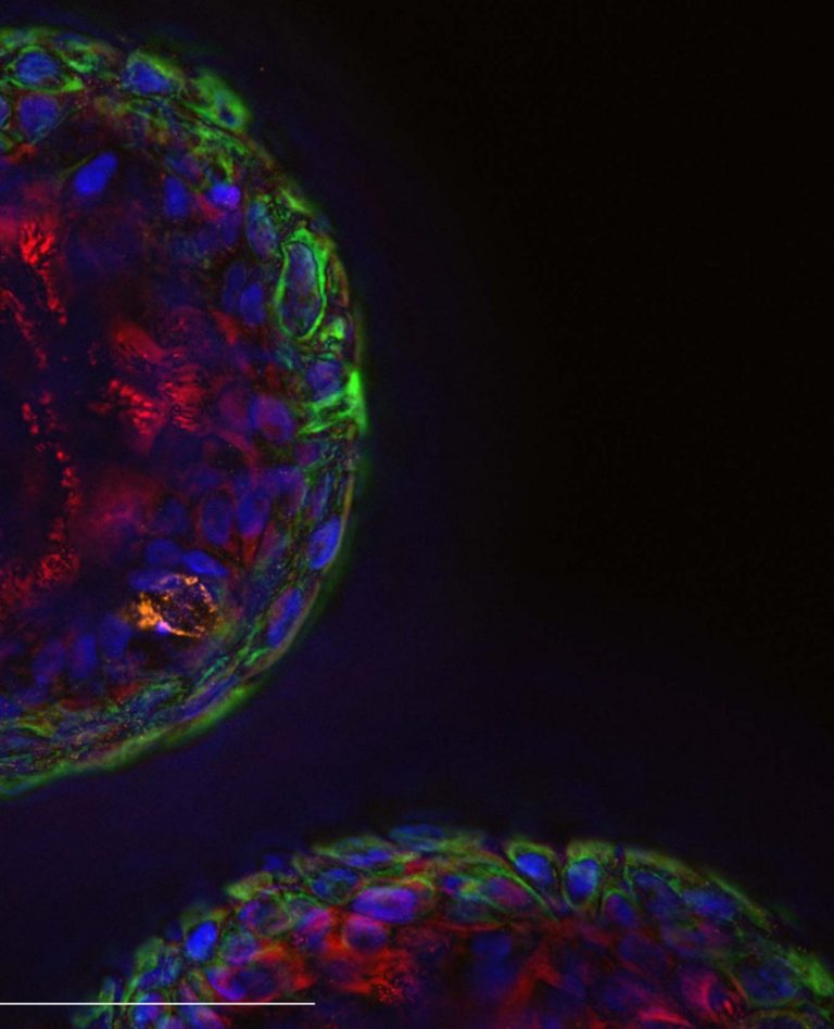 Corning® Matrigel® Matrix for Organoids | Disease Modeling and Drug ...