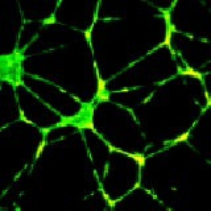 Angiogenesis Research Process in Cancer | Research, Resources, and ...
