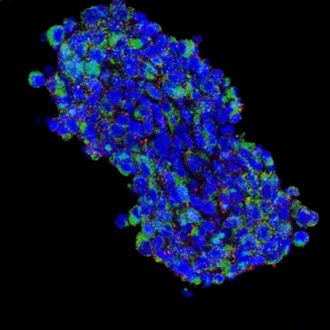 Tumorigenesis Research Lab Tools | 3D Tumor Spheroid Models | Corning