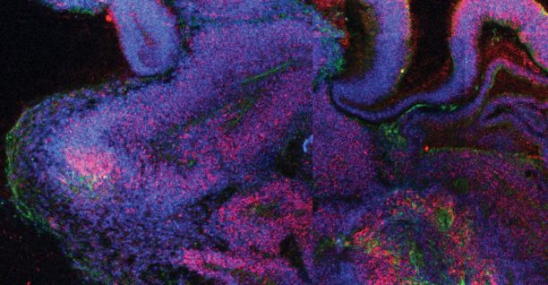 Corning® Matrigel® Matrix for Organoids | Disease Modeling and Drug ...
