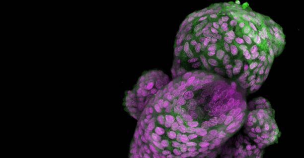 Corning® Matrigel® Matrix for Organoids | Disease Modeling and Drug ...