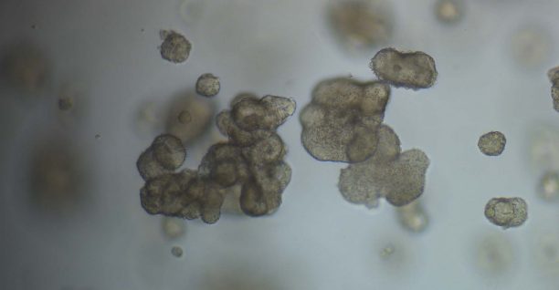 Corning® Matrigel® Matrix for Organoids | Disease Modeling and Drug ...