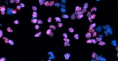 Spheroid Microplates | Microplates | Corning