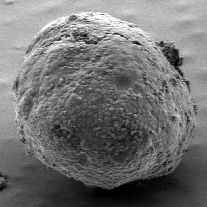 Scaling up with Spheroids Opens up New Possibilities in Cancer Therapy ...