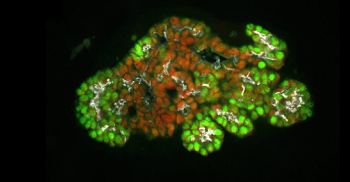 Cryogenic Storage and Preservation | CoolCell | Corning