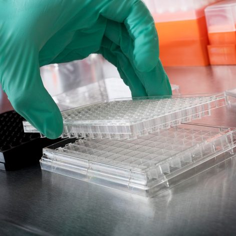 Corning Transwell Cell Migration Assay Ultimate Guide