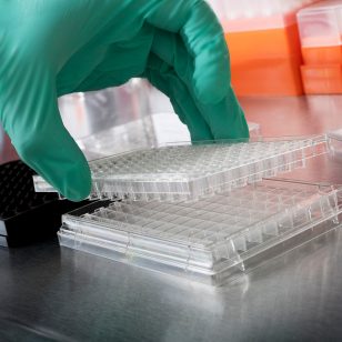 Corning Transwell Cell Migration Assay Ultimate Guide