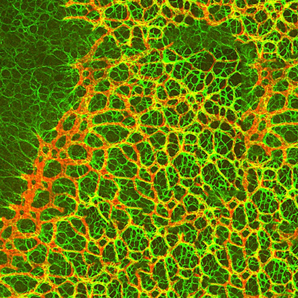 Angiogenesis Research Process in Cancer | Research, Resources, and ...