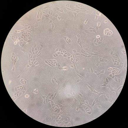 Cell Culture Contamination | How to Prevent Contamination in Cell ...