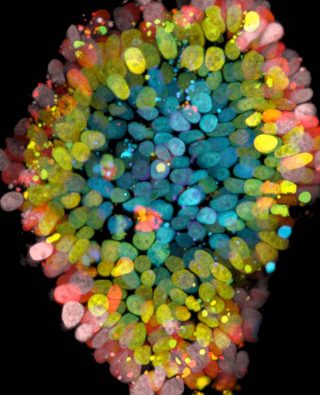 Corning® CellBIND® 表面｜マイナスチャージの先進的な細胞培養表面｜Corning