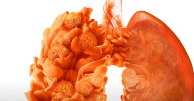 Corning® Matrigel® Matrix for Organoids | Disease Modeling and Drug ...