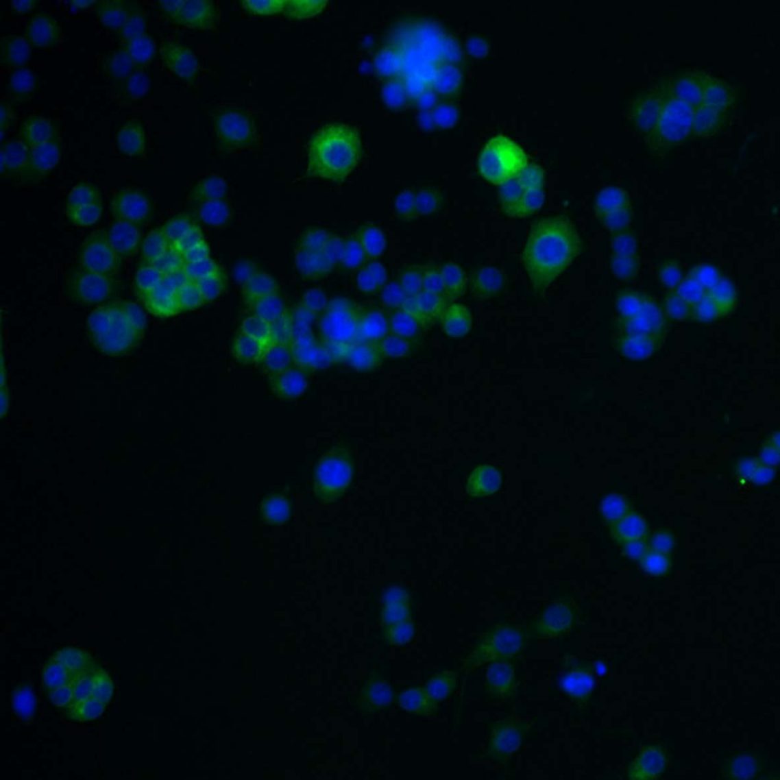 High Content Screening (HCS) Microplates | High Content Imaging | Corning