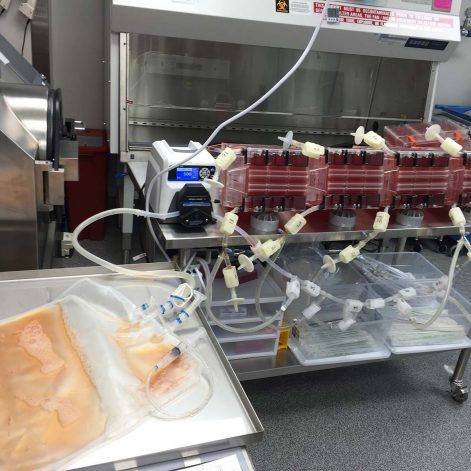 同種細胞療法：マスター細胞バンク、ワーキング細胞バンク、製剤を効果的に開発