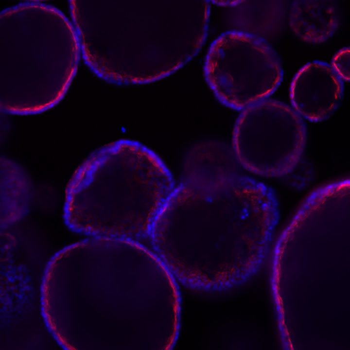 Cell Culture Protocol: Best Practice in Spheroid and Organoid Cultures