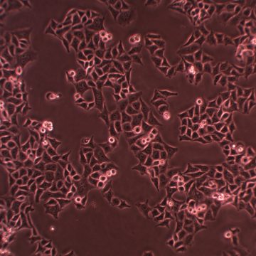 Cell Culture Contamination | How to Prevent Contamination in Cell ...