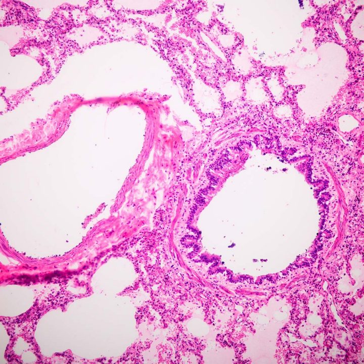 Air-Liquid Interface Culture Research | ALI Cell Culture | Corning