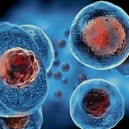3D Organoids Lead the Way for Personalized Cancer Therapy | Cancer ...