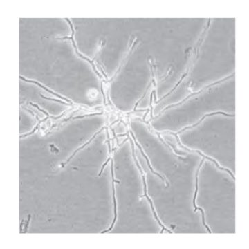 Cell Culture Contamination | How to Prevent Contamination in Cell ...