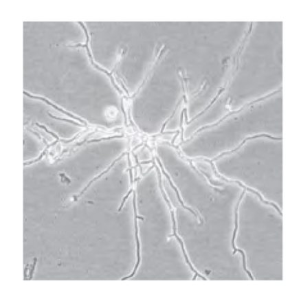 Cell Culture Contamination: How to Prevent Fungal, Yeast, and Bacterial ...