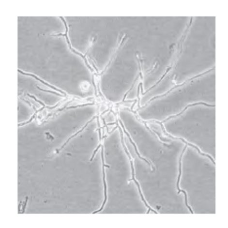 Cell Culture Contamination | How to Prevent Contamination in Cell ...