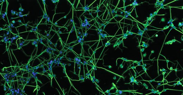 Permeable Supports | Individual Inserts | Corning