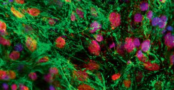 Neurobiology Applications | Cell Culture Solutions | Corning