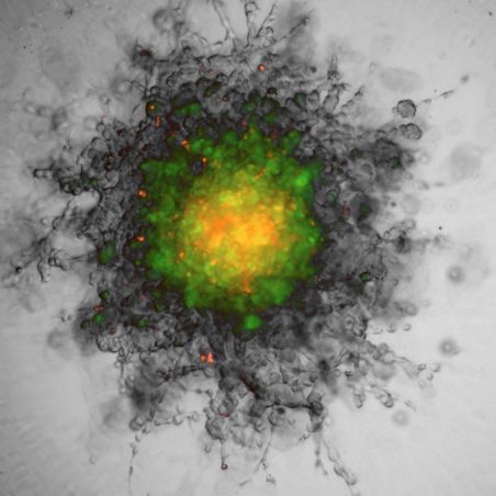 3D Spheroid Models | 3D Cell Culture Models | Corning