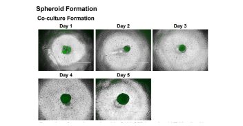 3D Spheroids | 3D Spheroid Cell Culture Models | Corning
