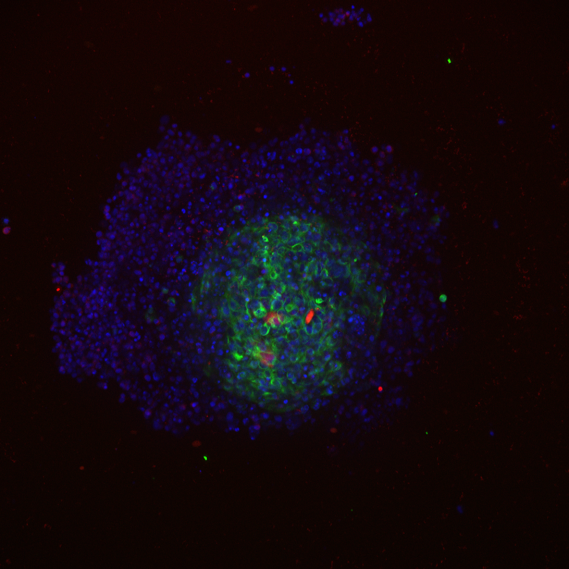 Spheroid Microplates | Microplates | Corning