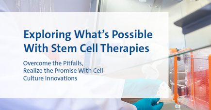 In-House Production vs. CDMO Cell Therapy Development Considerations ...