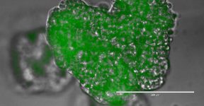 3D Spheroids | 3D Spheroid Cell Culture Models | Corning